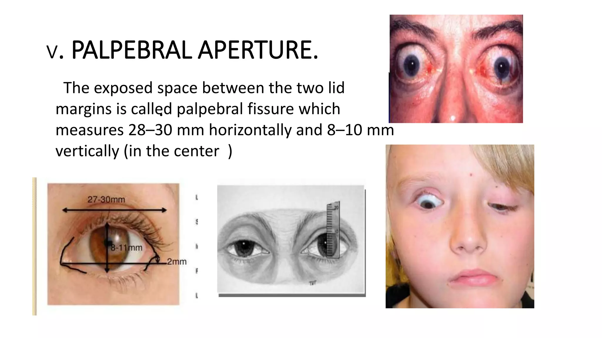Examination of eye | PPTX