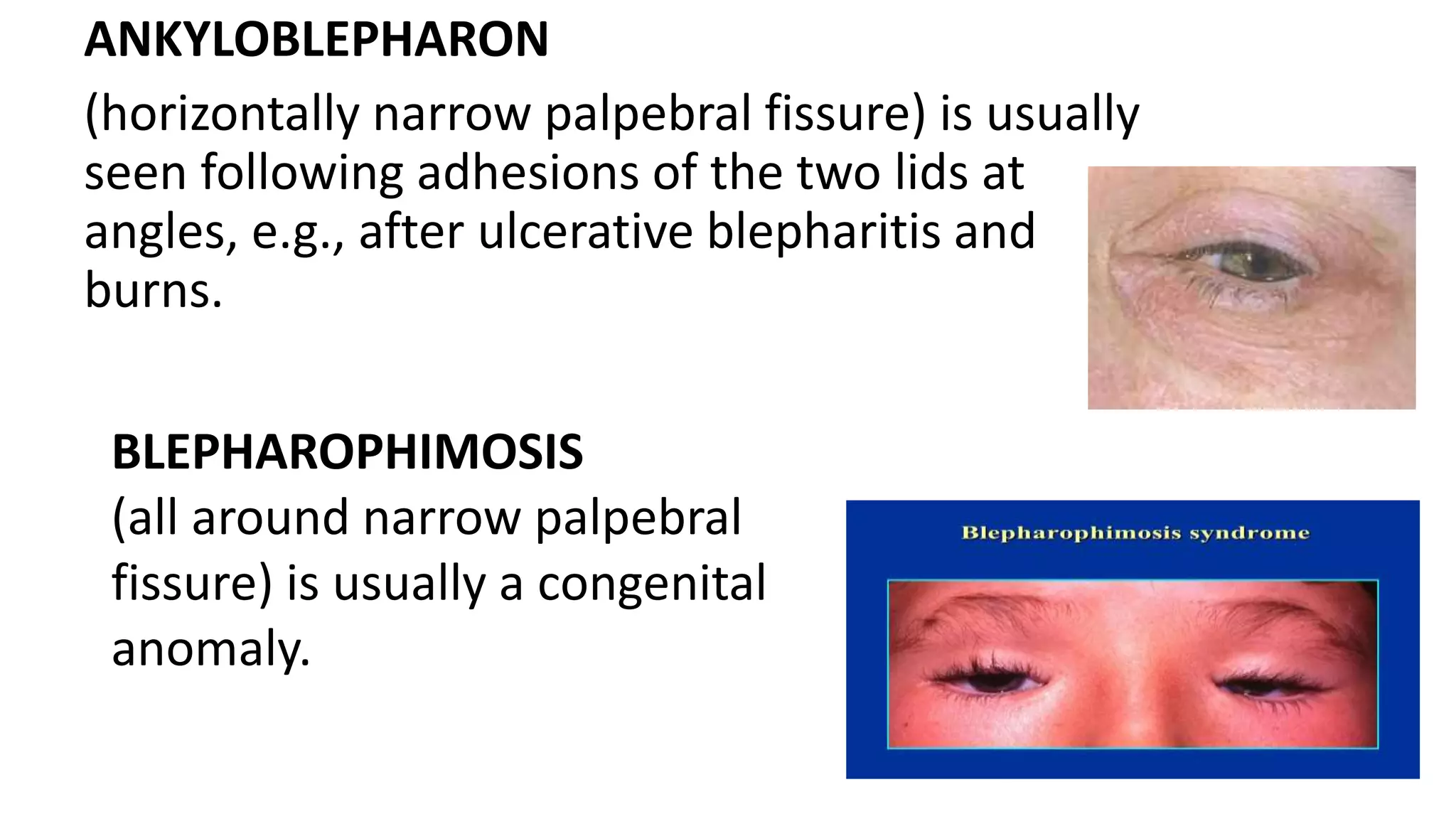 Examination of eye | PPTX