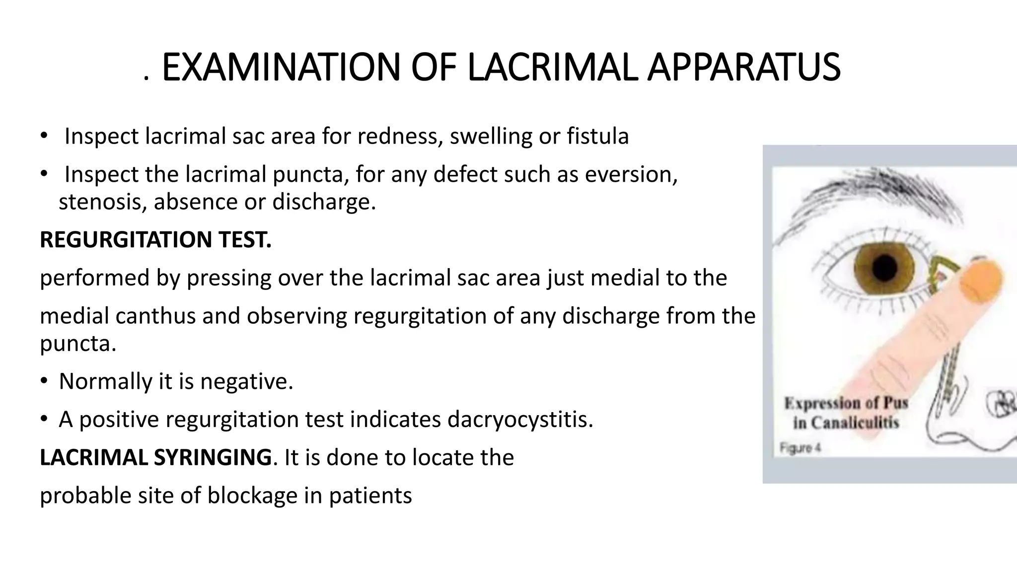 Examination of eye | PPTX