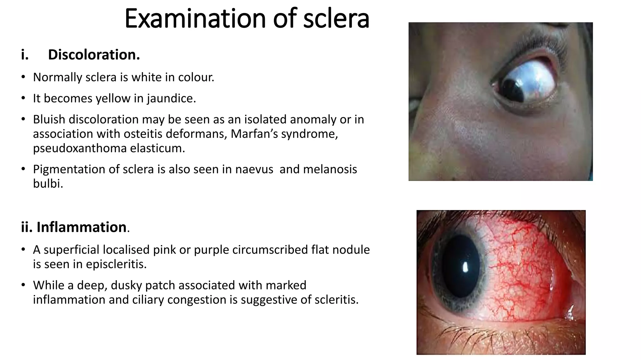 Examination of eye | PPTX