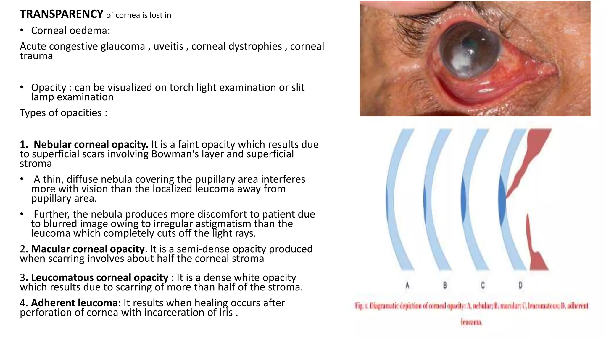 Examination of eye | PPTX