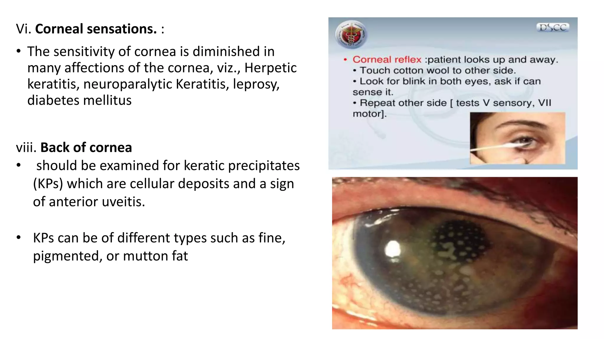 Examination of eye | PPTX