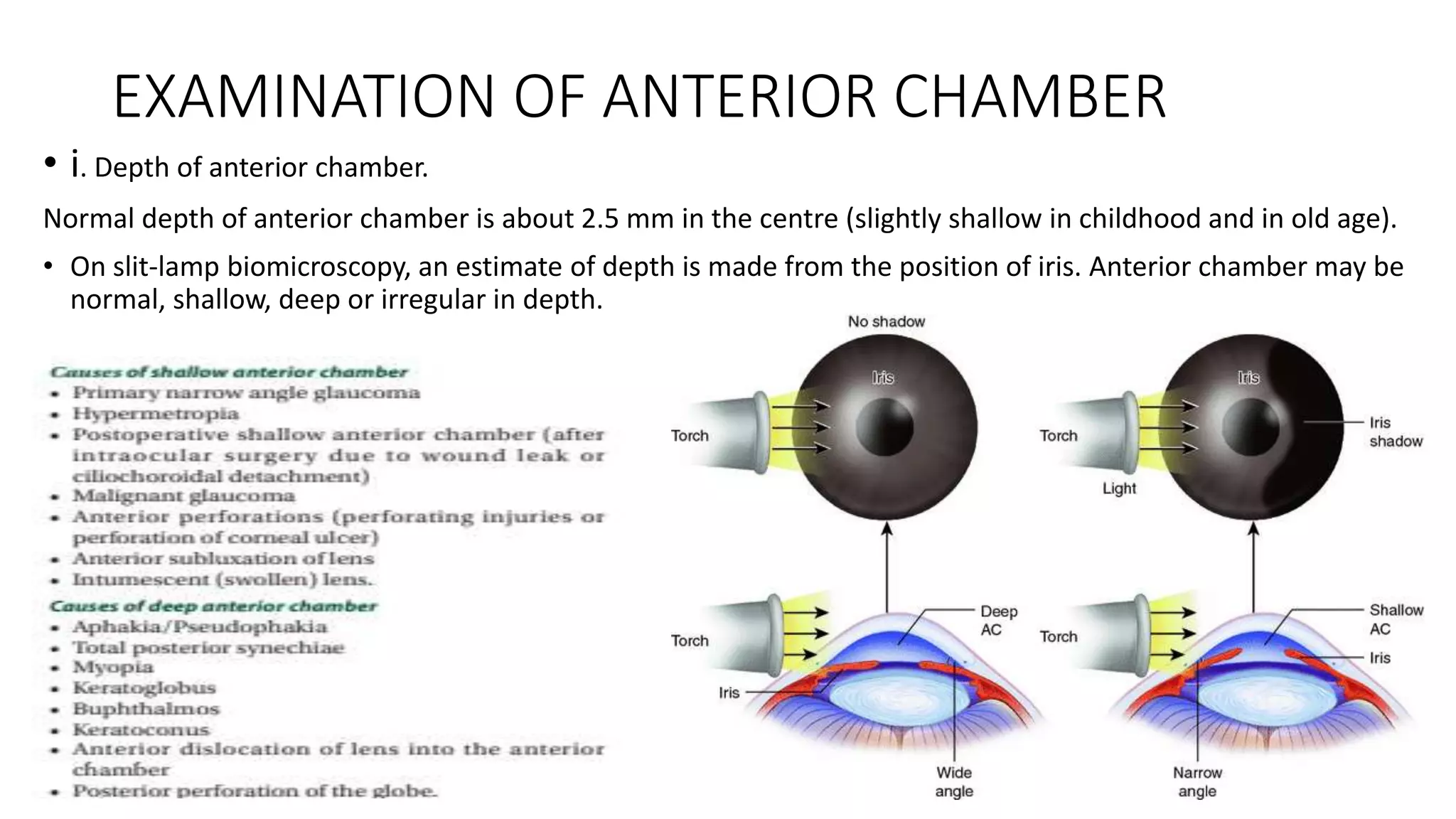 Examination of eye | PPTX