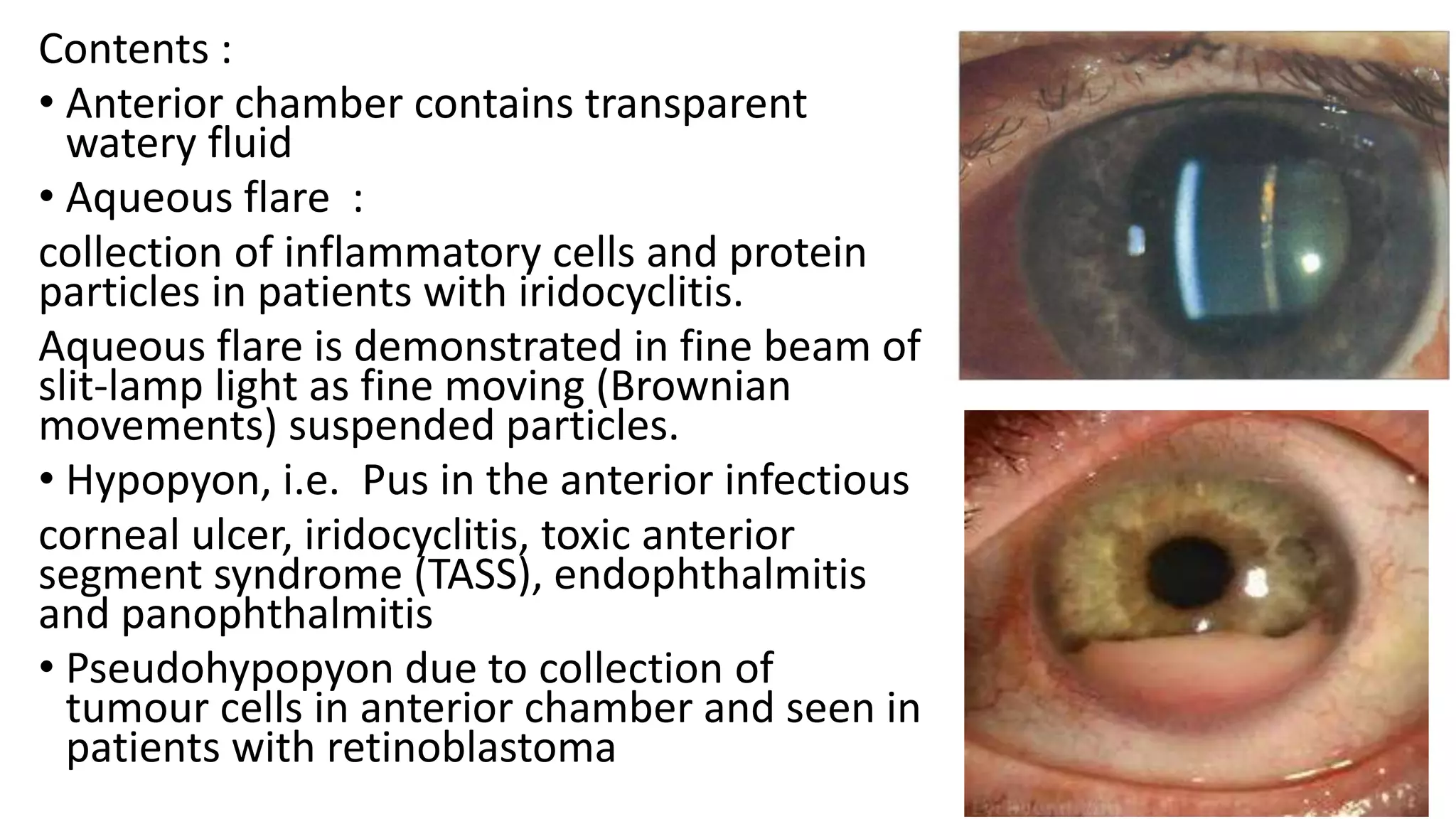 Examination of eye | PPTX