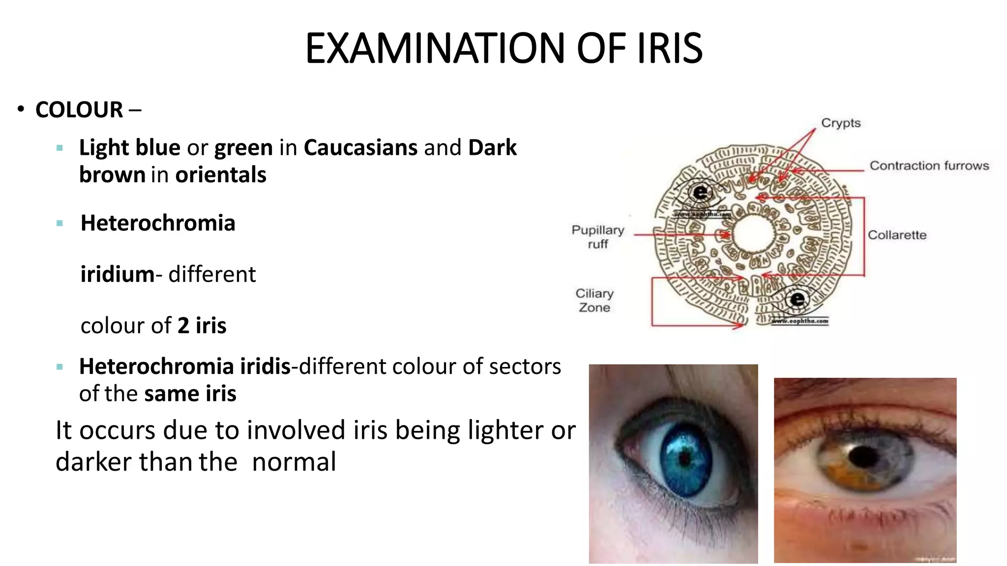 Examination of eye | PPTX