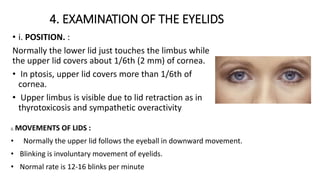 Examination of eye | PPTX