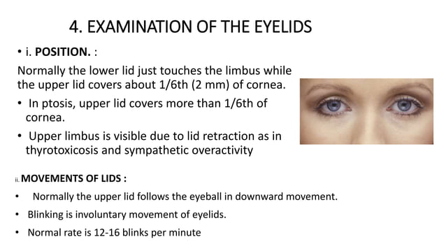 Examination of eye | PPTX