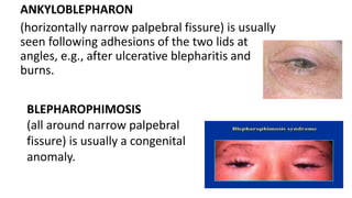Examination of eye | PPTX