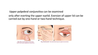 Examination of eye | PPTX
