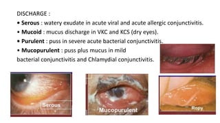 Examination of eye | PPTX