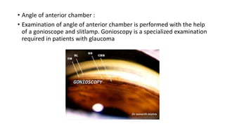 Examination of eye | PPTX