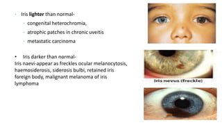 Examination of eye | PPTX