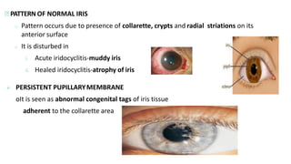 Examination of eye | PPTX