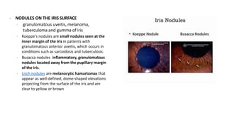 Examination of eye | PPTX