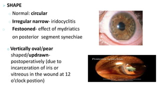 Examination of eye | PPTX