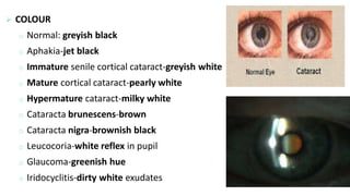 Examination of eye | PPTX