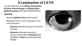 Examination of eye | PPTX