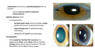 Examination of eye | PPTX