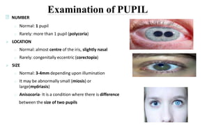 Examination of eye | PPT
