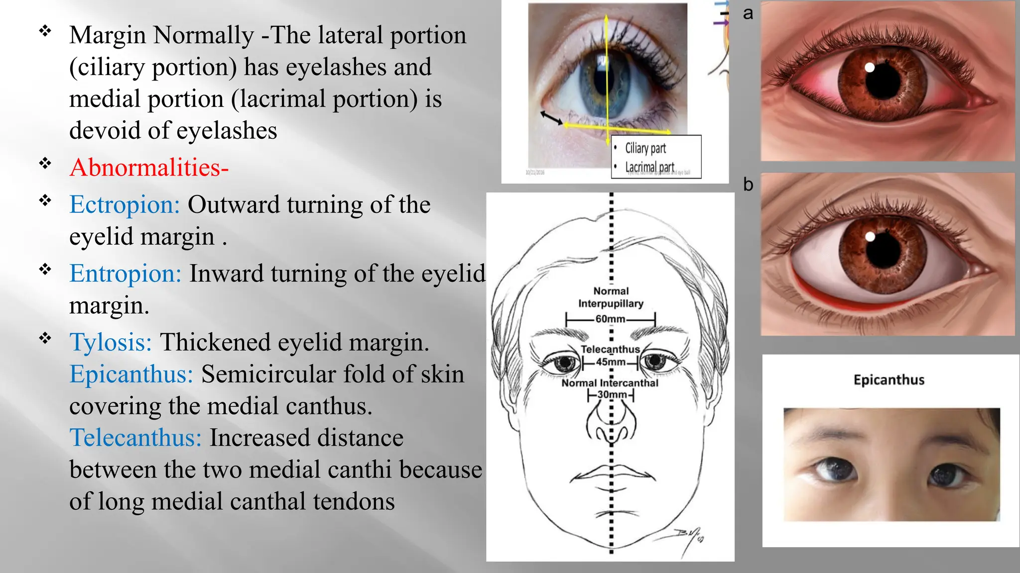Examination of eyelids.pptx, Normal,abnormalities. | PPTX