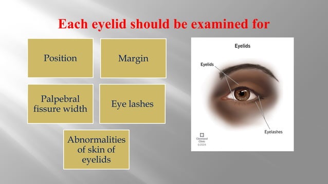 Examination of eyelids.pptx, Normal,abnormalities. | PPTX