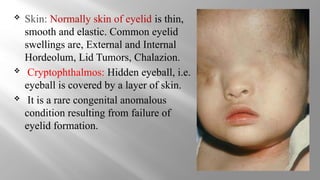 Examination of eyelids.pptx, Normal,abnormalities. | PPTX