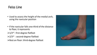 Examination of foot and ankle slideshare | PPT