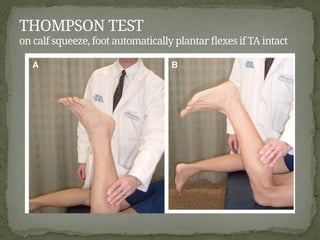 EXAMINATION OF FOOT AND ANKLE for pg.pptx