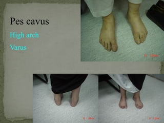EXAMINATION OF FOOT AND ANKLE for pg.pptx
