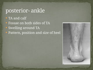 EXAMINATION OF FOOT AND ANKLE for pg.pptx