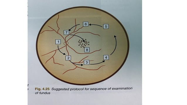 EXAMINATION OF FUNDUS and its description | PPT