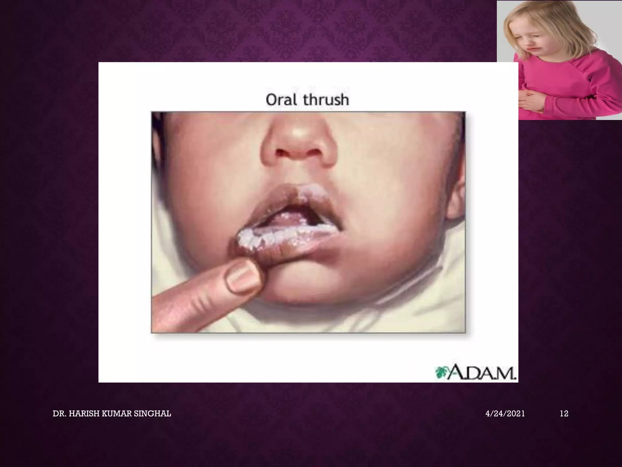 Examination of Pediatric Gastrointestinal tract | PDF