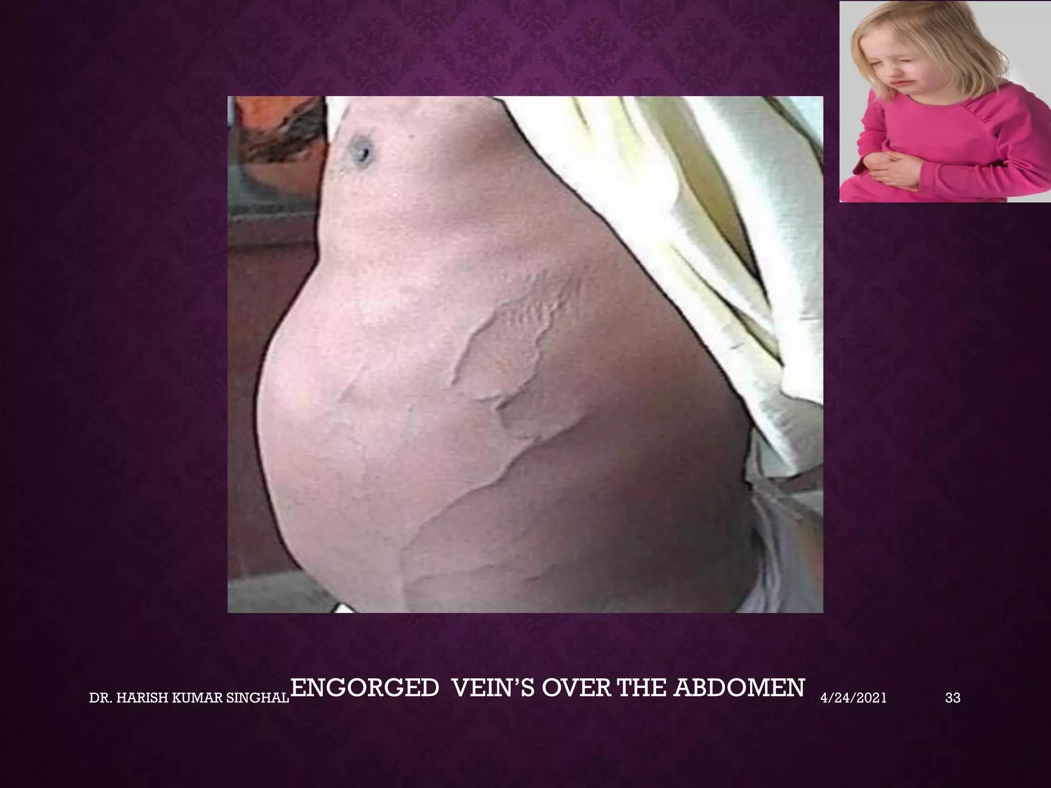 Examination of Pediatric Gastrointestinal tract | PDF