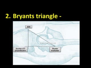 Examination of hip | PPTX