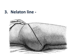 Examination of hip | PPTX