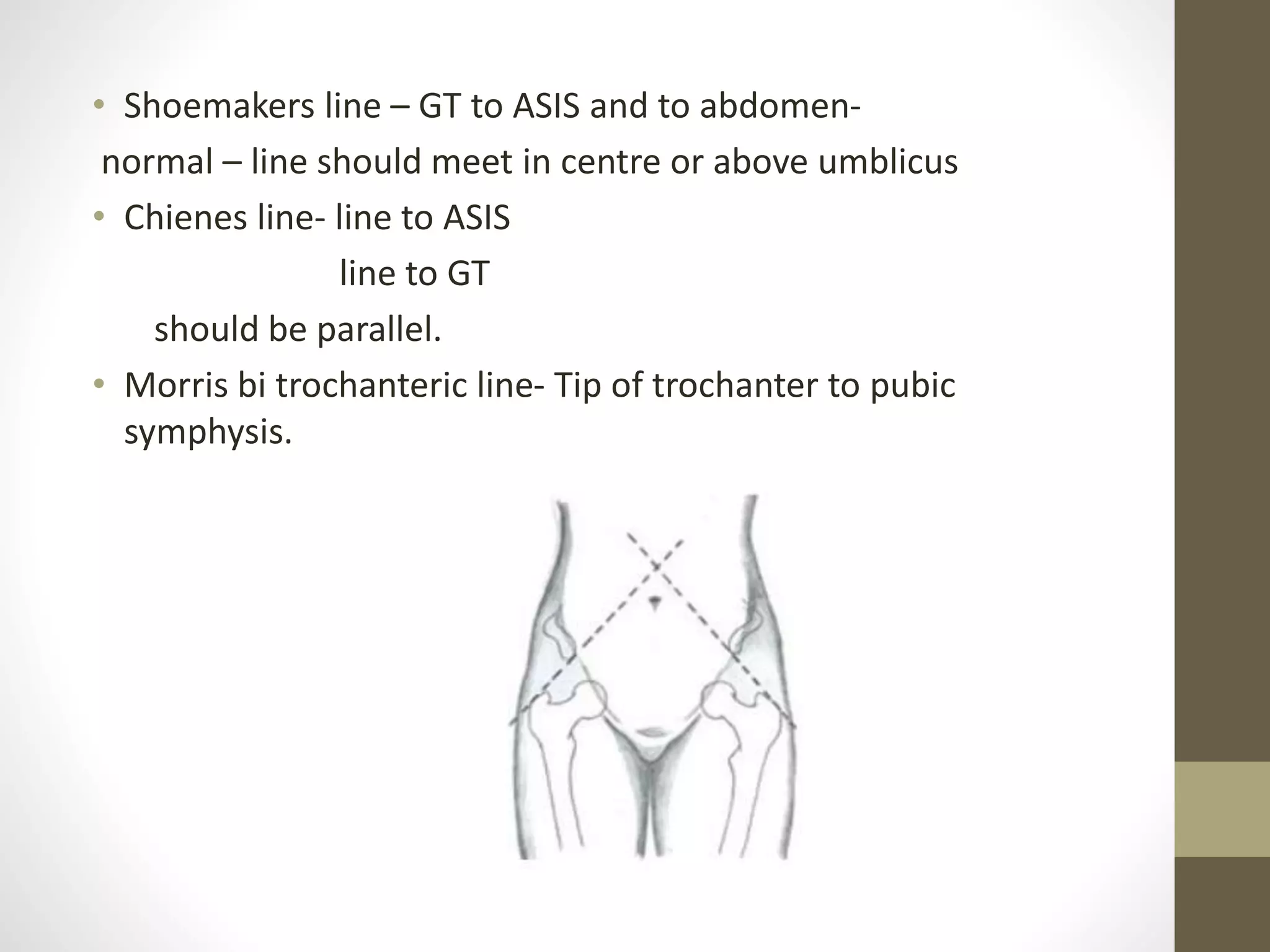examination of hip .pptx