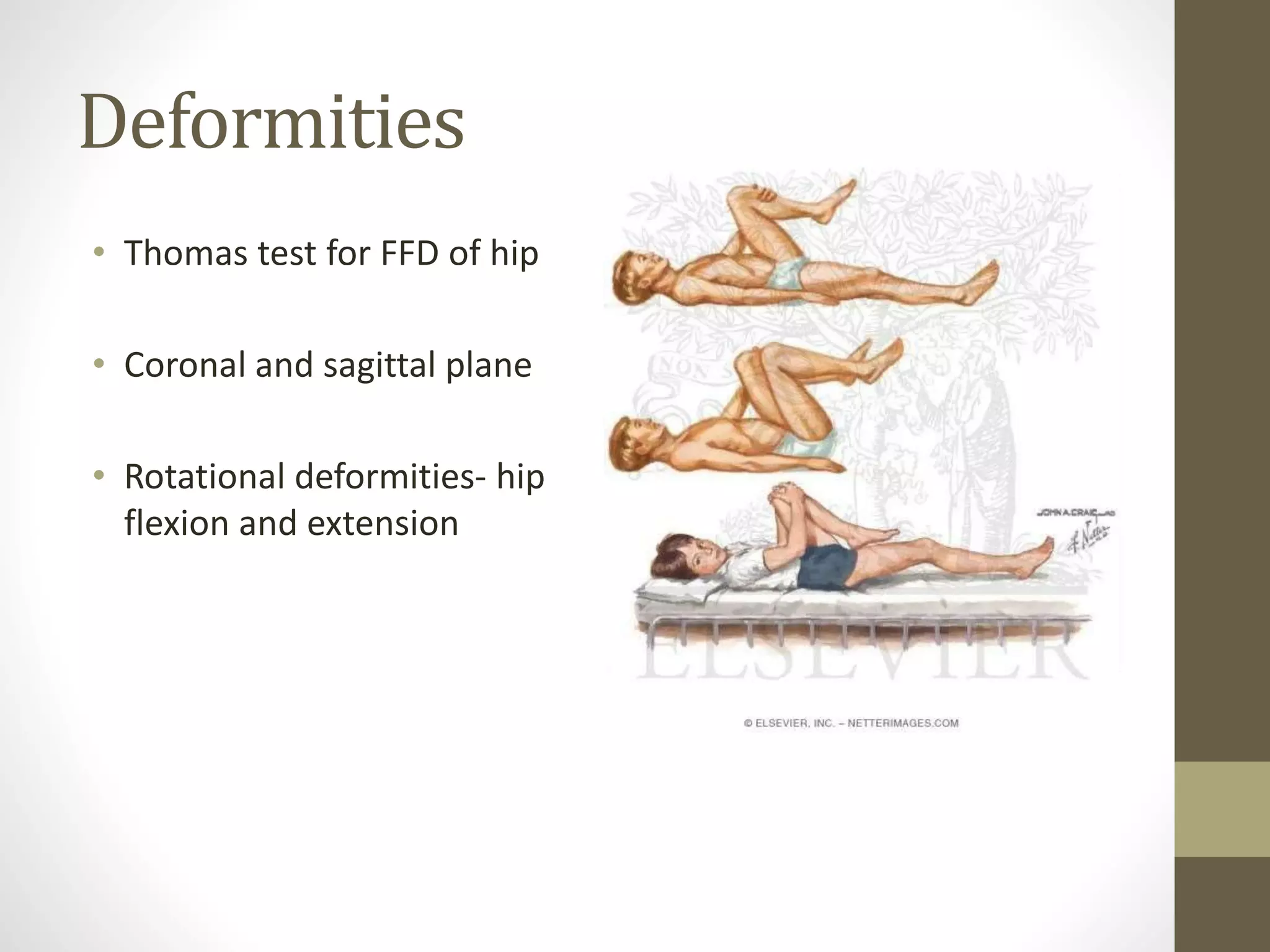 examination of hip .pptx