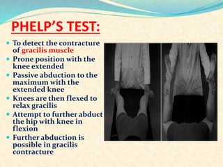 Examination of hip joint | PPTX