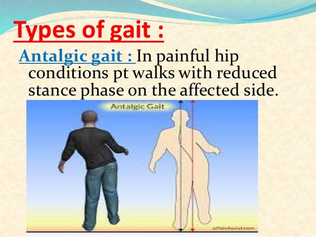 Examination of hip joint
