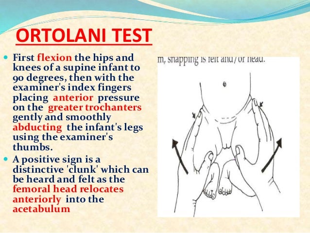 Examination of hip joint