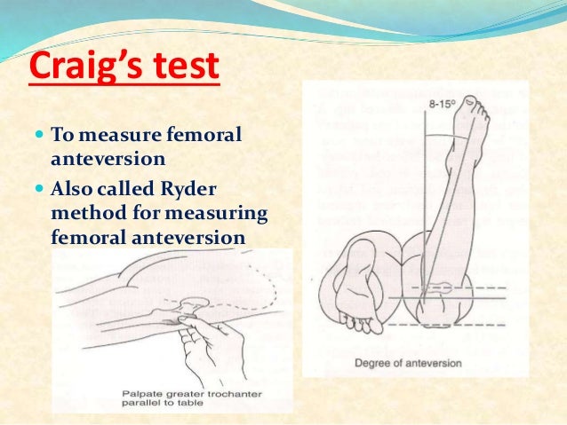 Examination of hip joint