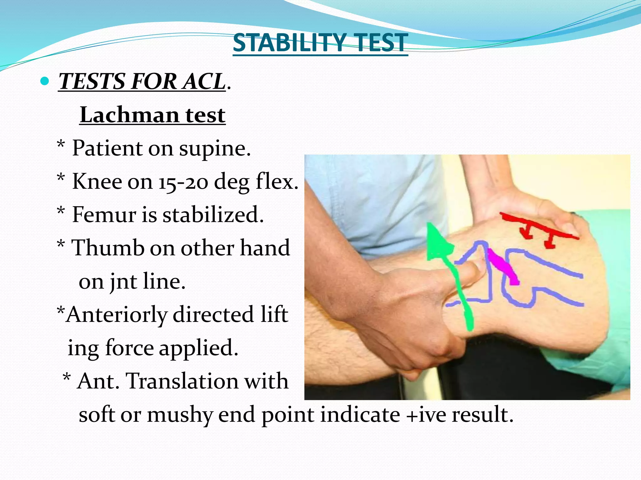 Examination of knee | PPTX