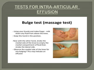 Knee Exam Tests