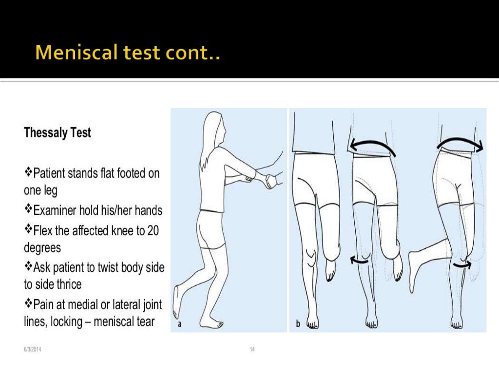 Examination of knee