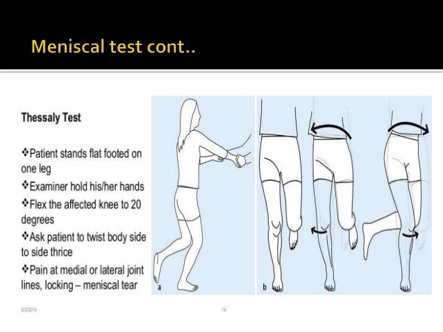 Examination of knee