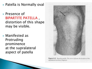 Examination of knee psmc | PPTX