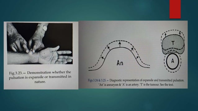 examination of lump.pptx