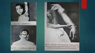 examination of lump.pptx