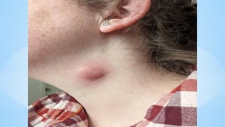 Examination of Lumps.pptx7777777777777777777777777 | PPTX