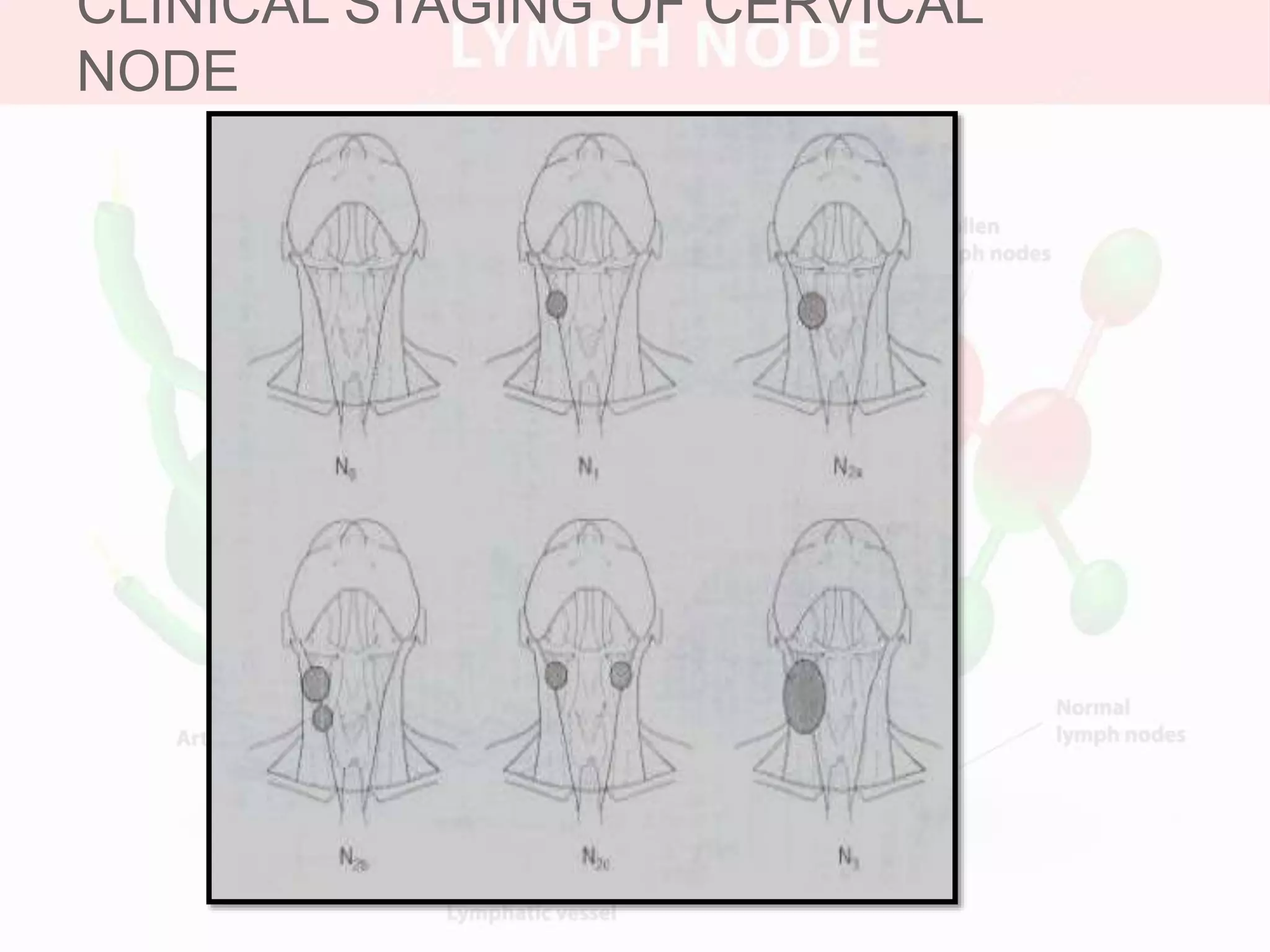EXAMINATION OF LYMPH NODE..pptx